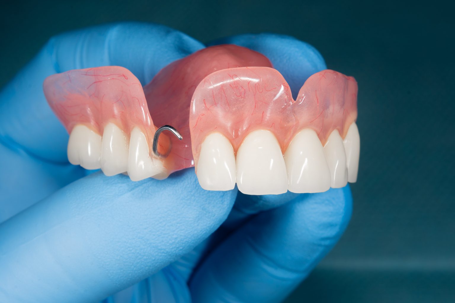Choosing the Right Dental Partials Near You | Legacy Dental of PA